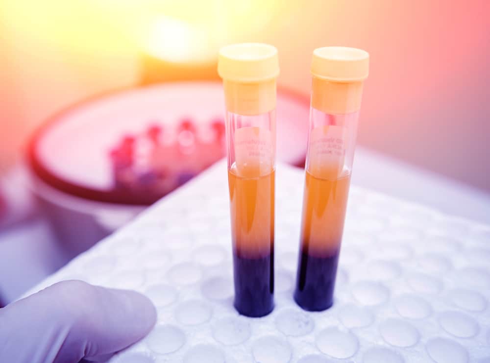 How Are Cell Based Therapies Performed? | SDOMG