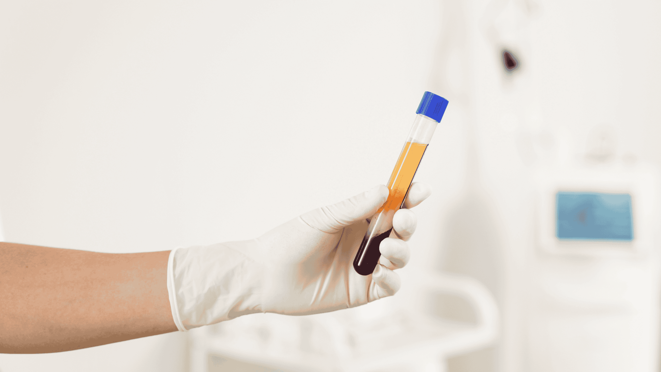 What to Know About PRP Injection Therapy | SDOMG
