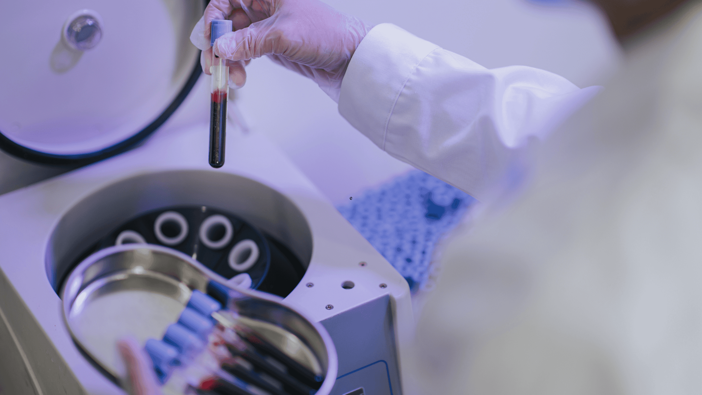 PRP Injections: What Patients Need to Know - San Diego Orthobiologics ...