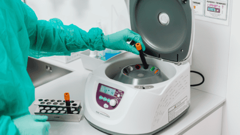 Can Regenerative Treatments Help Avoid Surgery? - San Diego ...